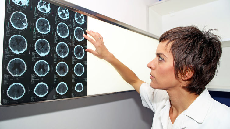 Do Strokes Affect Women Differently News Do Strokes Affect Women Differently News