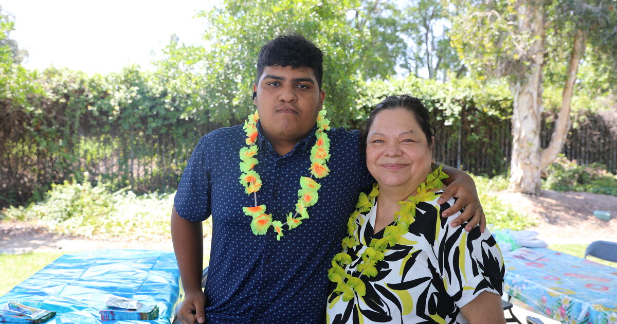 One mother’s journey through her son’s cleft lip diagnosis | News