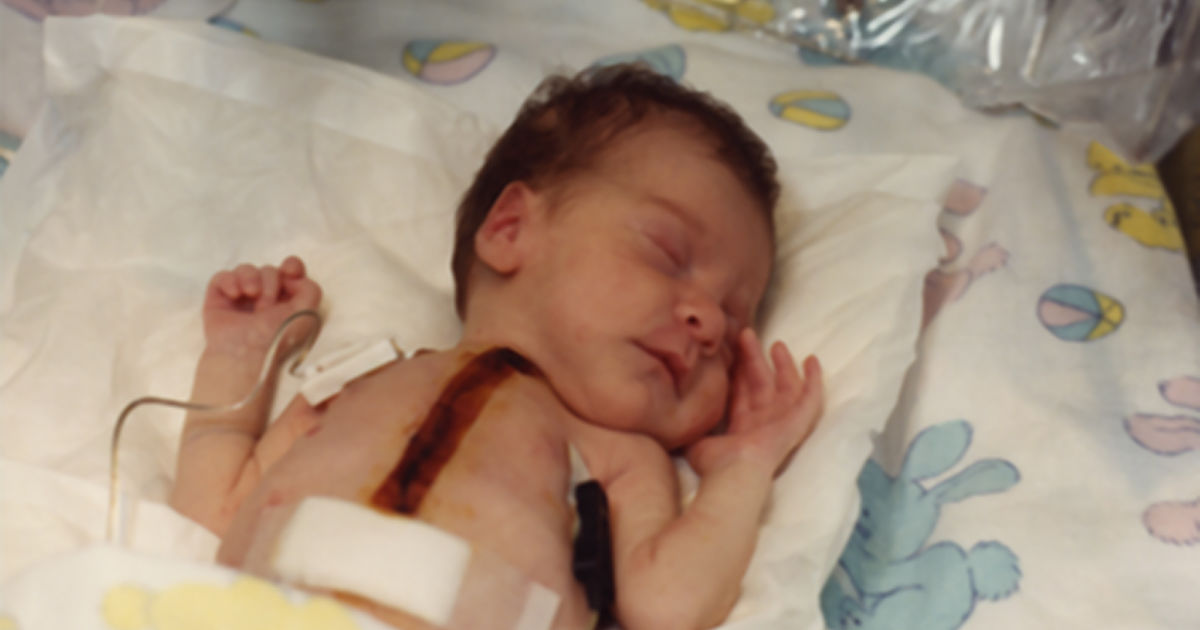 Baby Fae: A Chronology | News