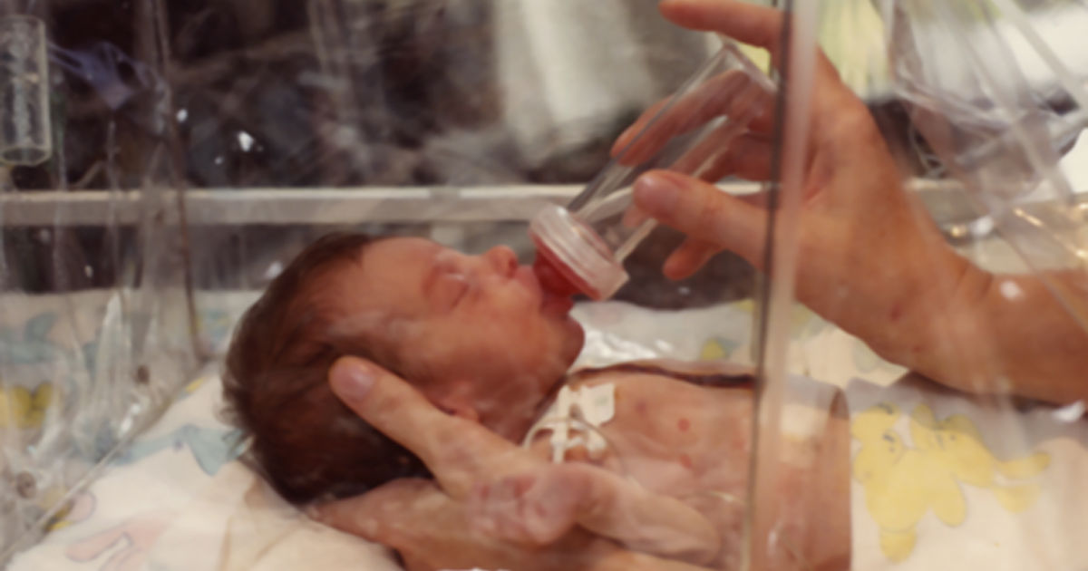 Baby Fae: As a Wondering World Watched | News