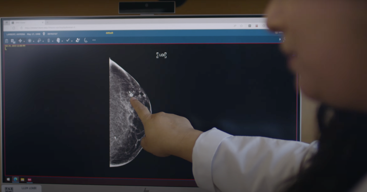 Waiting on breast cancer screening results? Here’s the likelihood of a ...