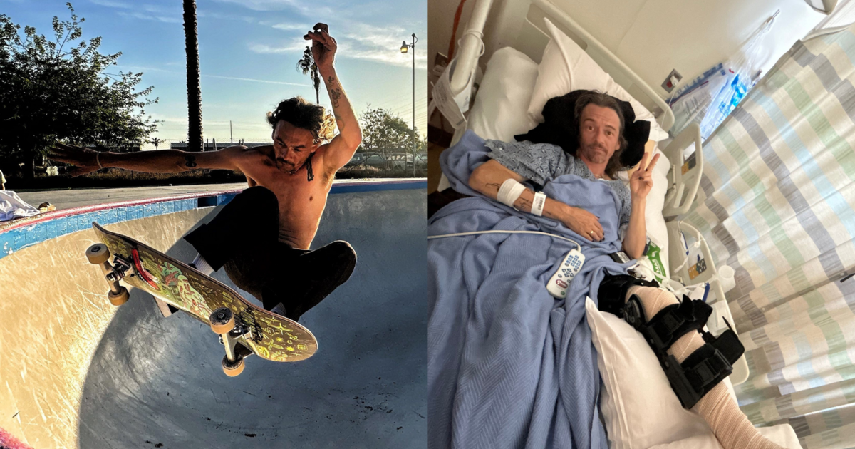 The trick that split his tibia: a skateboarder's story of recovery ...